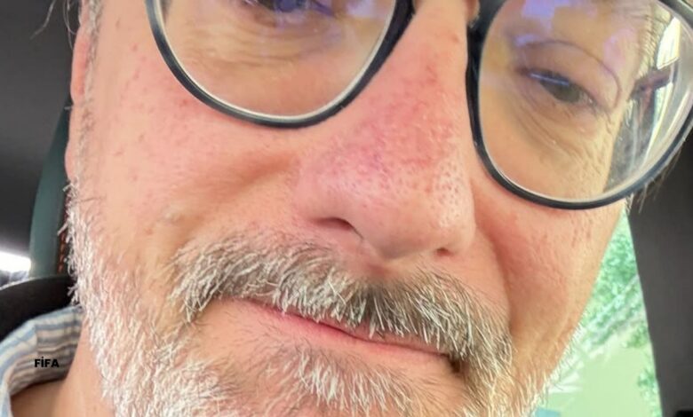 Nuno Markl deixa hospital: "Melancolia para a alta"